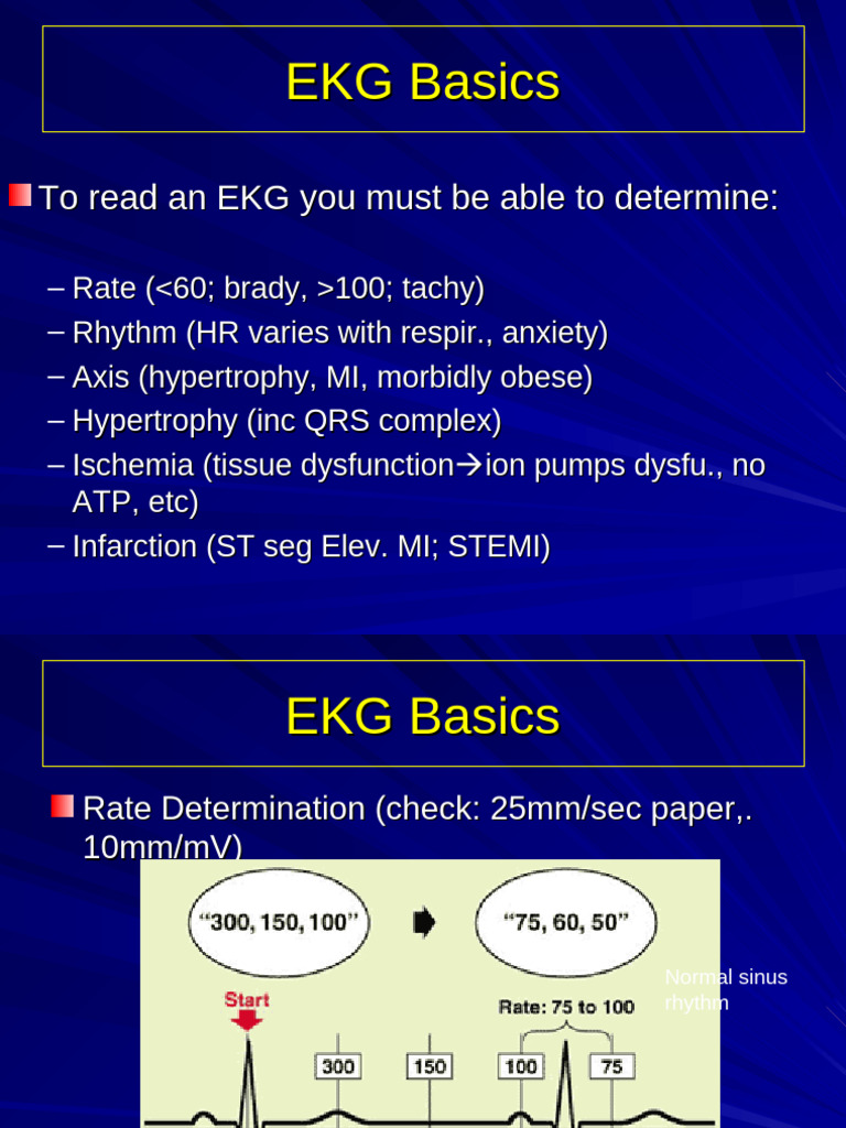 (030613) 17 - Essentials of EKG, Rate, Rhythm and Axis BM | PDF ...