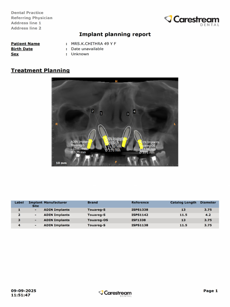 Chithra Implant Planning | PDF