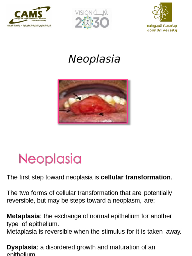 2 - Neoplasia-2zxscdfgvhbjnkml, Aqwsedrftgyhuijkol | PDF | Neoplasms ...