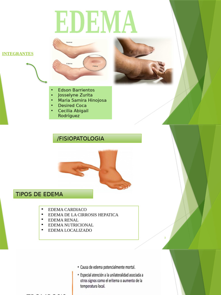Edema Semiologia G1-2 | PDF | Edema | Especialidades Medicas