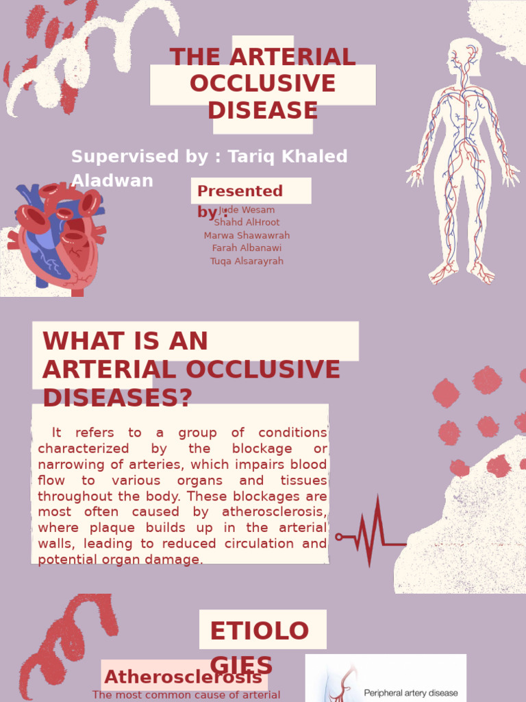 Understanding Arterial Occlusive Disease | PDF | Ischemia | Atherosclerosis