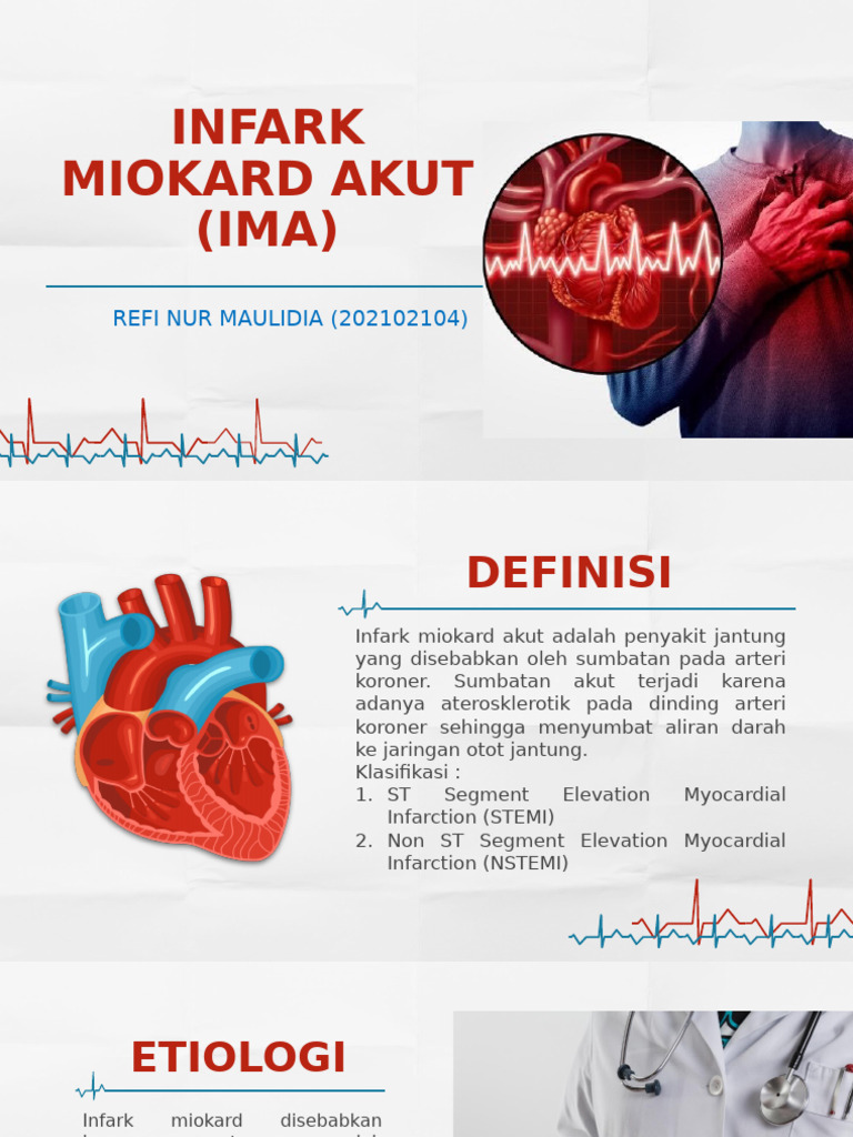 Infark Miokard Akut: Gejala dan Penanganan | PDF