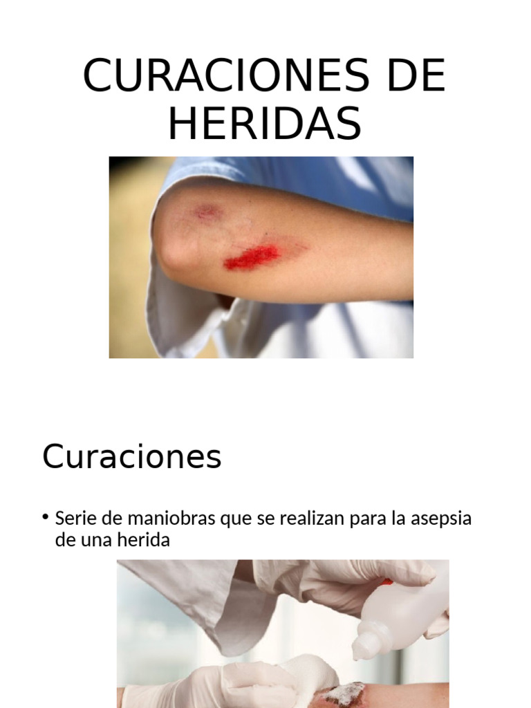 Guía Completa sobre Curaciones de Heridas | PDF | Herida | Hombro