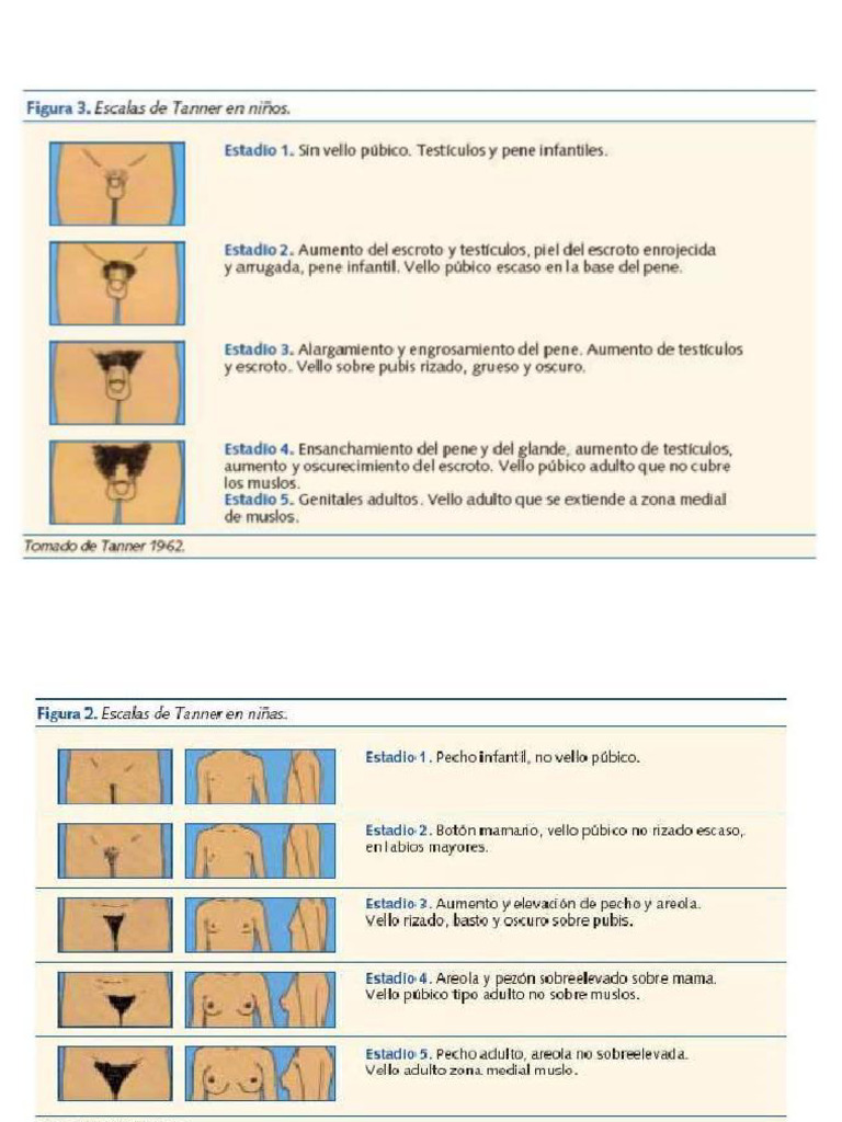 Escala de Tanner | PDF