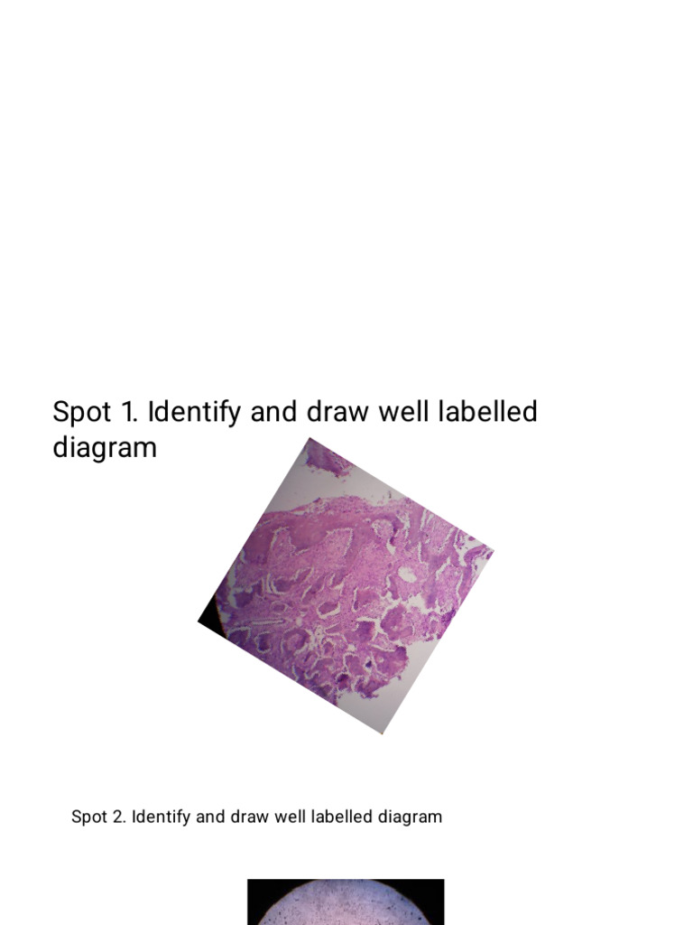 Spotting First Year | PDF