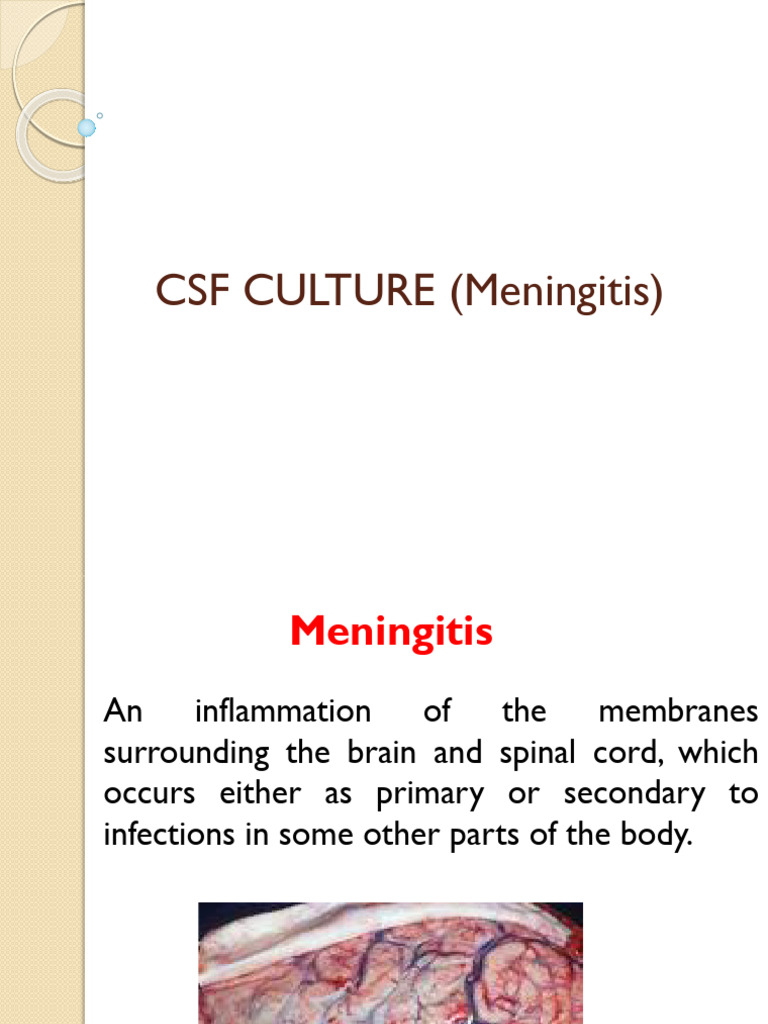 Meningitis CSF Diagnosis Guide | PDF | Meningitis | Cerebrospinal Fluid