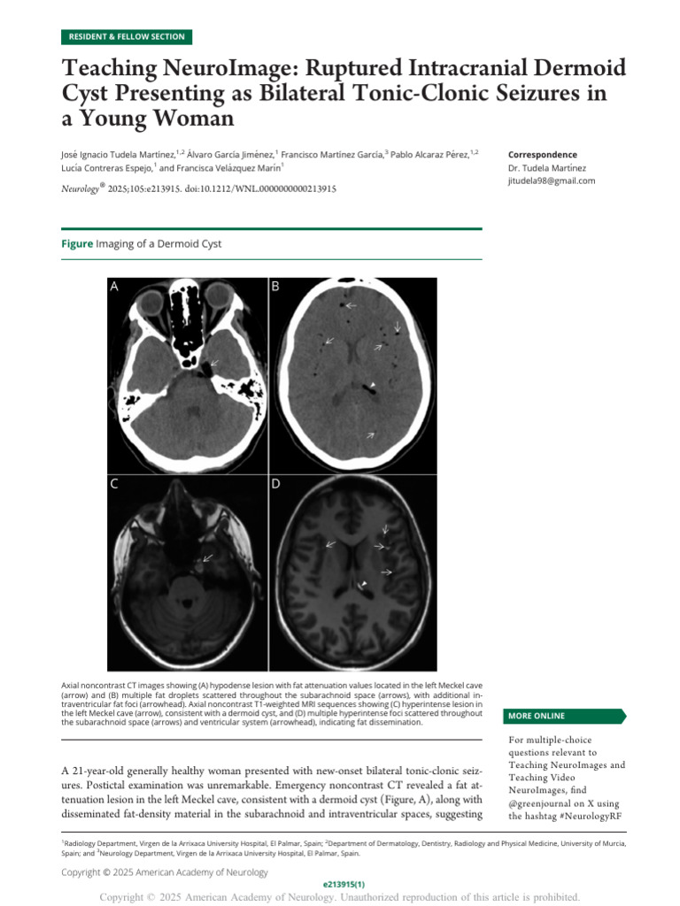 Tudela Martínez Et Al 2025 Teaching Neuroimage Ruptured Intracranial ...
