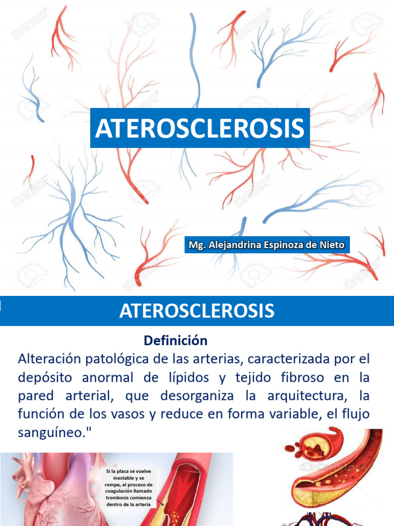 Aterosclerosis: Causas, Síntomas y Tratamientos | PDF | Aterosclerosis ...