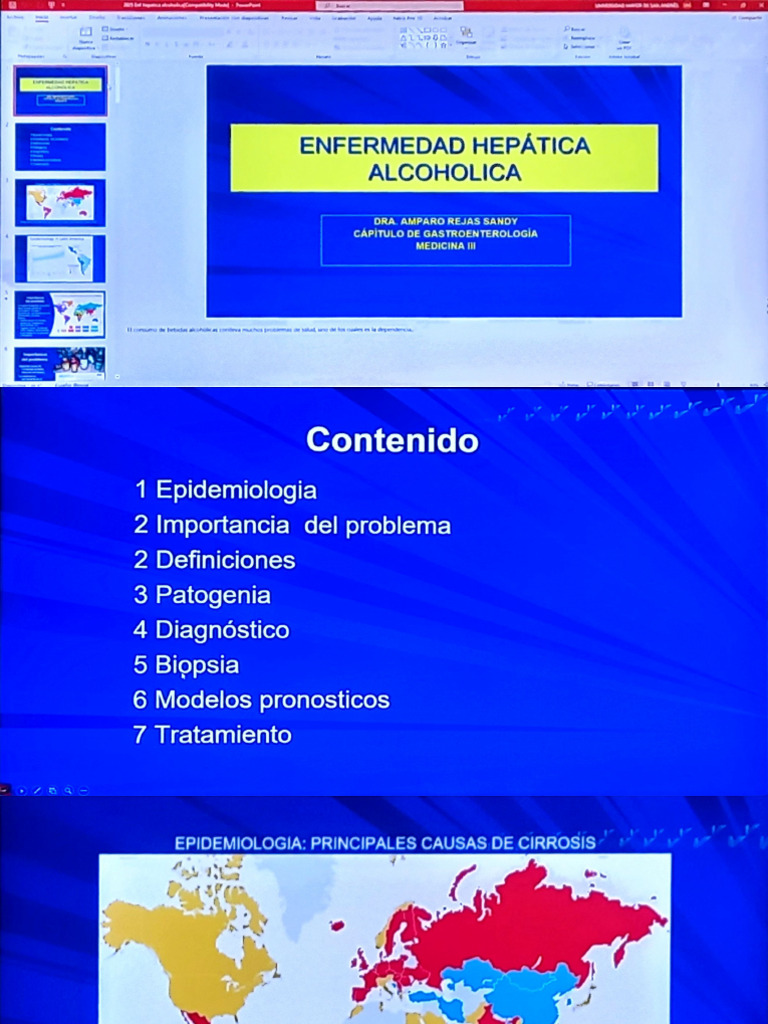 G17-Enfermedad Hepática Alcohólica-DRA REJAS | PDF