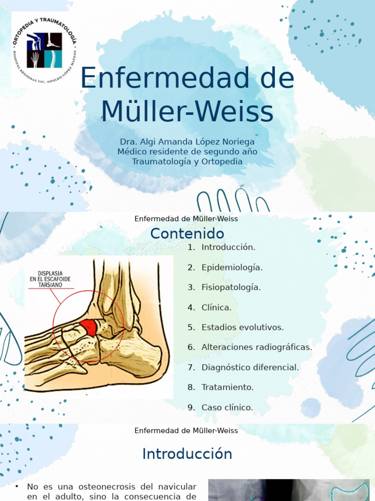 Enfermedad de Müller-Weiss: Diagnóstico y Tratamiento | PDF | Pie | Tobillo