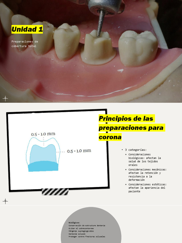 Unidad 1 - Coronas | PDF | Odontología