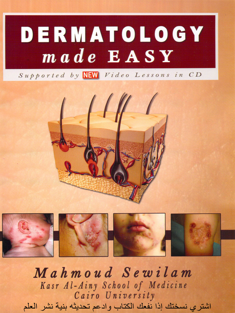 Dermatology Made Easy: Fourth Edition | PDF | Skin | Dermatology