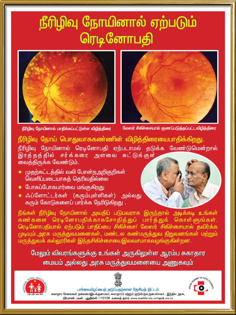 IEC Eye | PDF