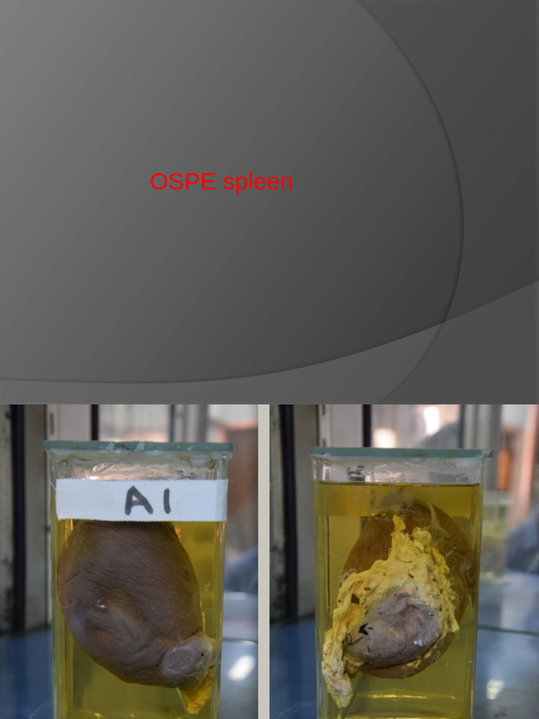 OSPE Spleen | PDF