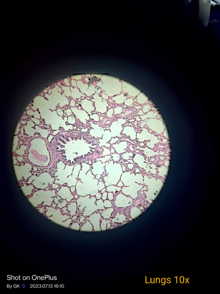 Histo (Lungs) ? | PDF