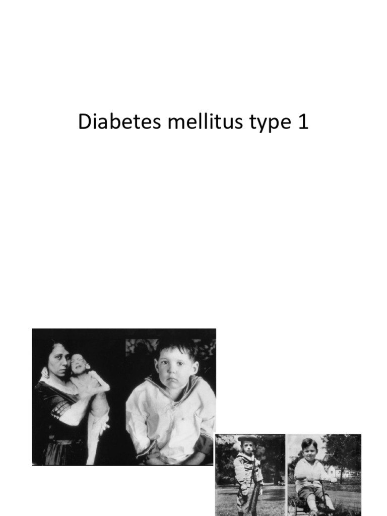 Type 1 Diabetes | PDF