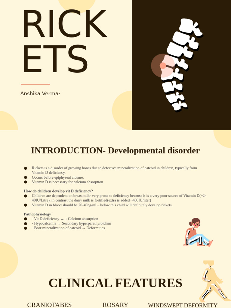 Case Report On Bone Diseases - Rickets by Slidesgo | PDF | Bone | Vitamin D
