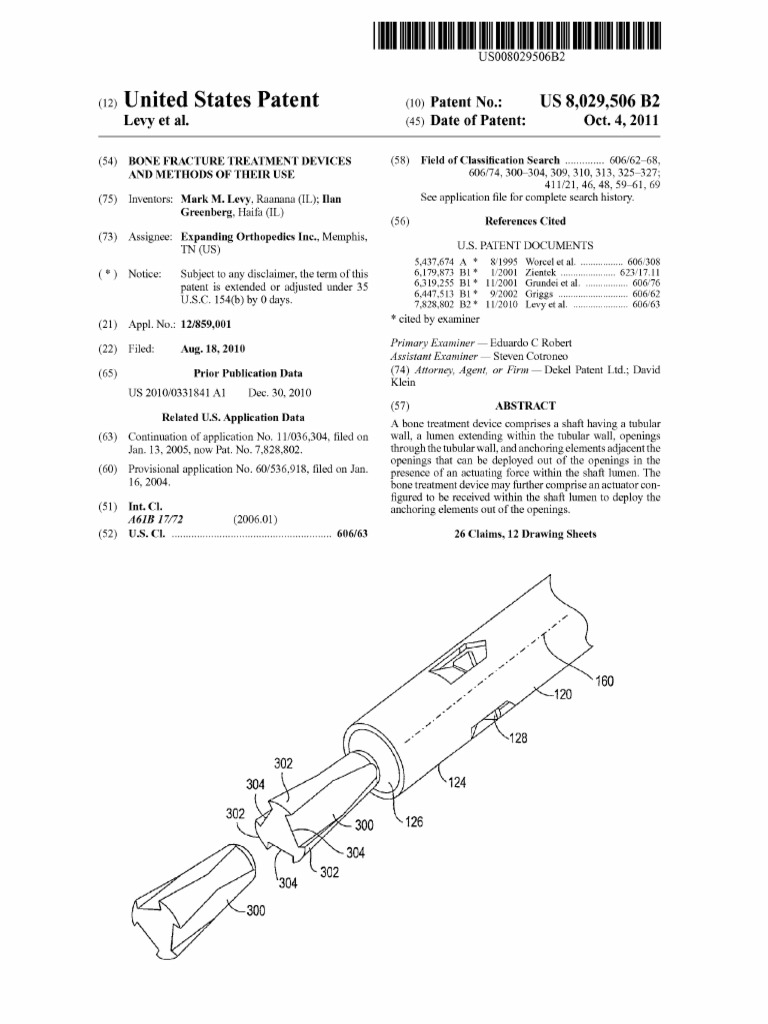 Bone Fracture Treatment Device Patent | PDF | Bone | Elasticity (Physics)