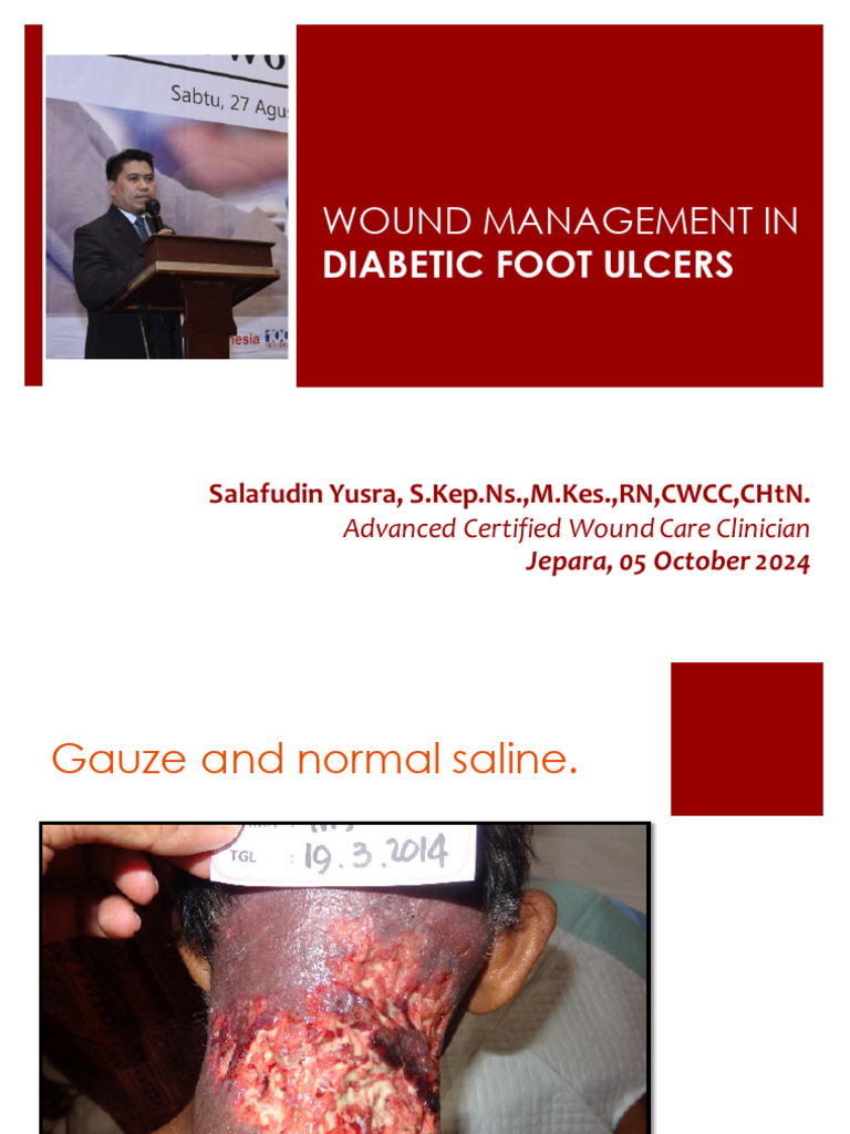 Diabetic Foot Ulcer Management Guide | PDF | Wound | Medicine