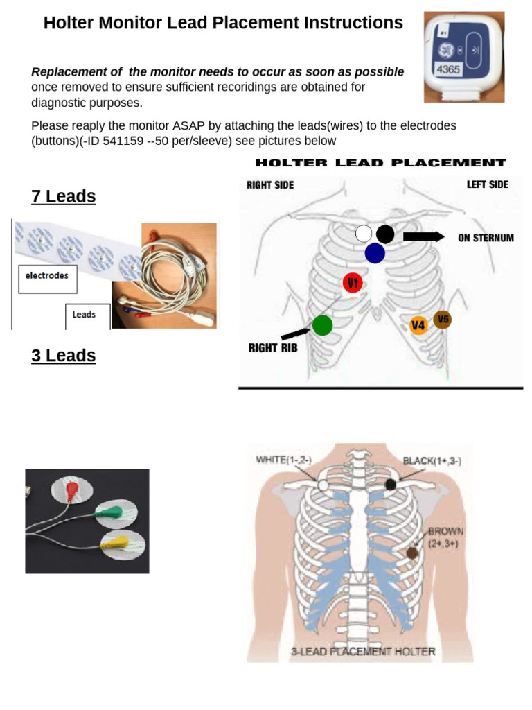 Holter Monitor Lead Placement Instructions | PDF
