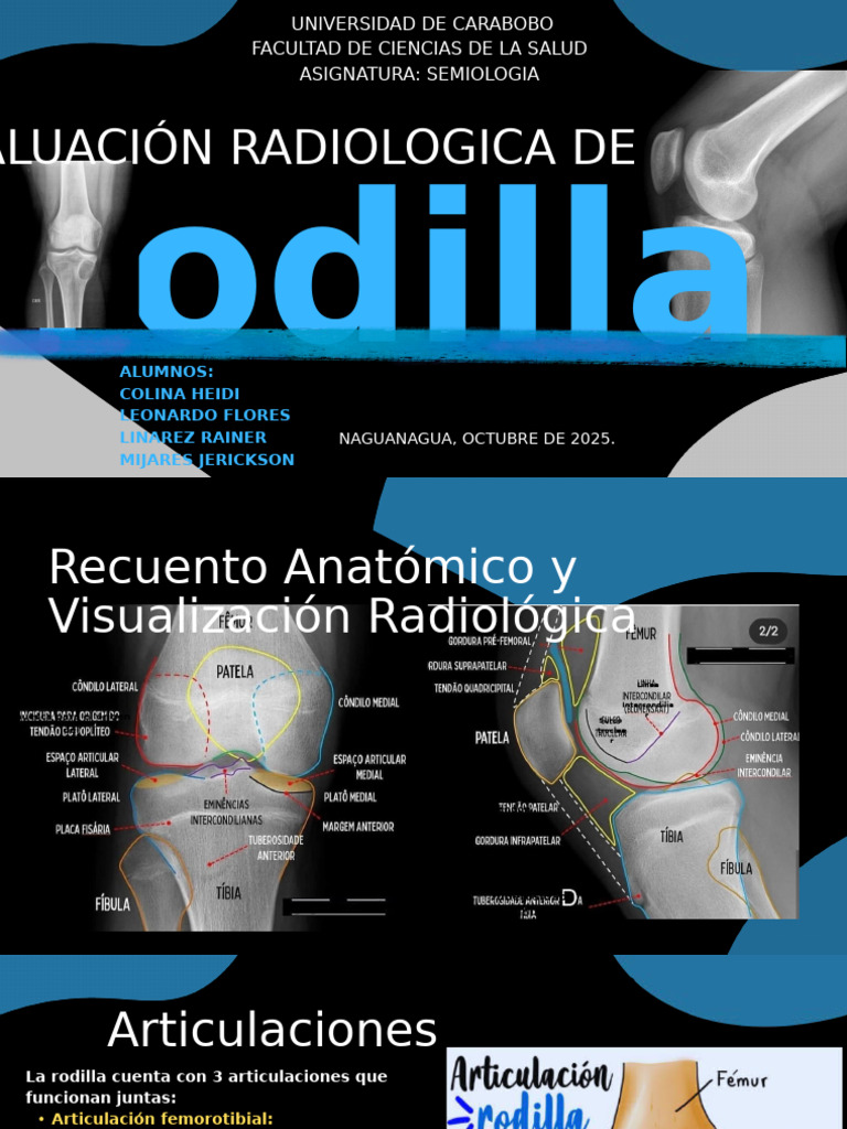 RODILLA | PDF | Rodilla | Hueso