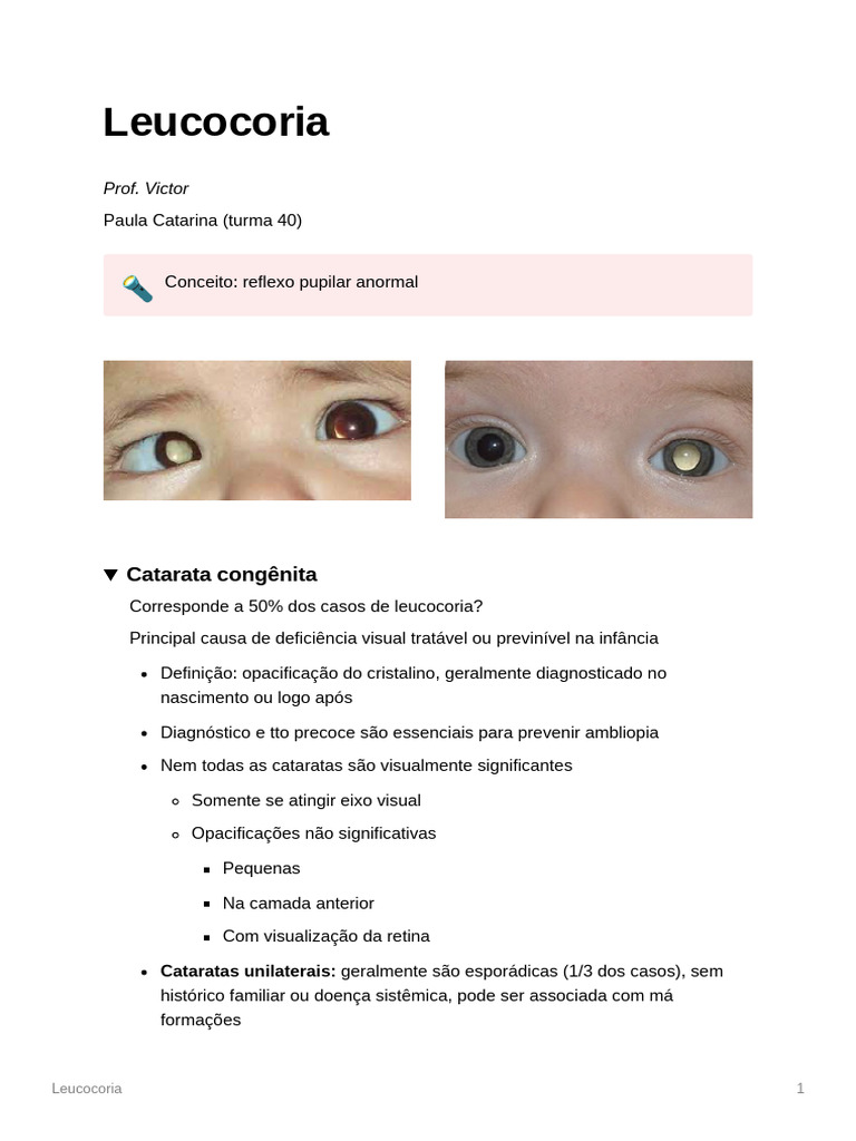 Resumo - Leucocoria | PDF | Catarata | Sistema visual