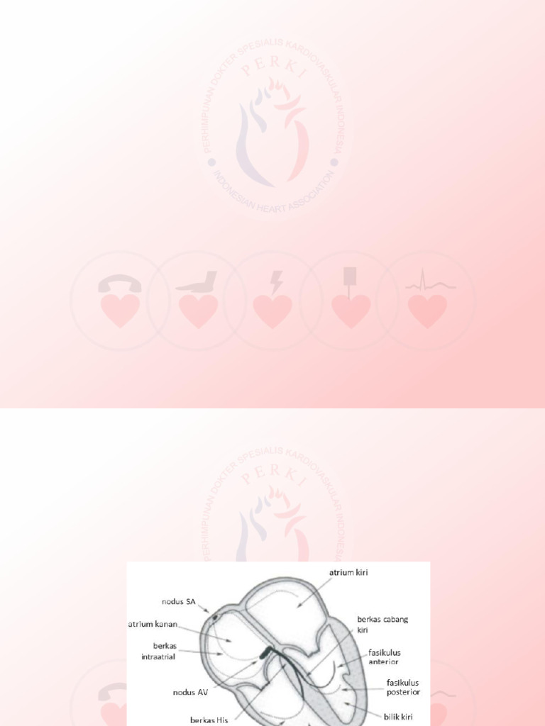 Pengenalan Irama EKG dan Takiaritmia | PDF