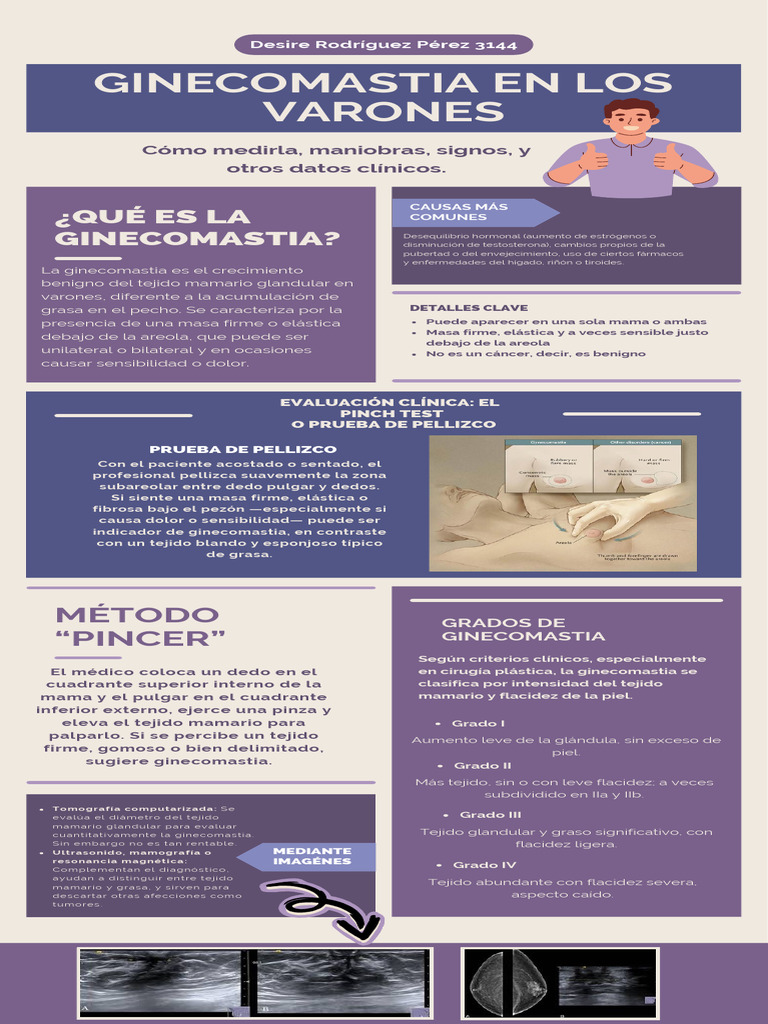 Ginecomastia: Evaluación y Pinch Test | PDF | Pecho | Enfermedades y ...