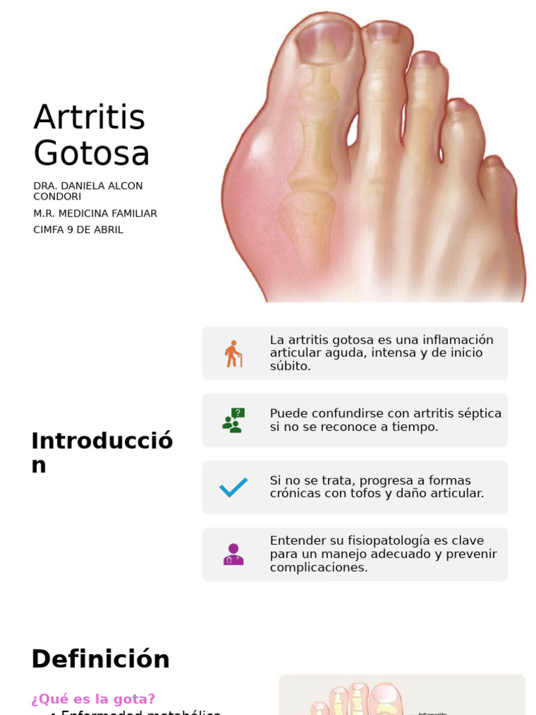 Artritis Gotosa | PDF | Gota | Medicina CLINICA