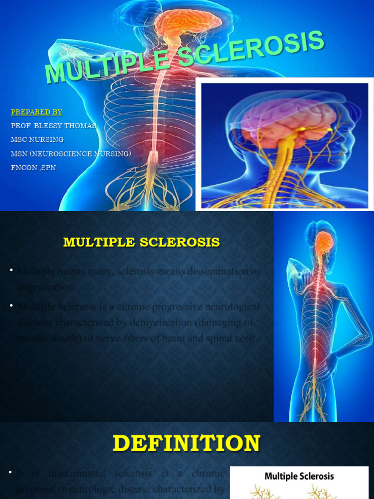 Multiplesclerosisppt 240611072154 98feb49a | PDF | Multiple Sclerosis ...