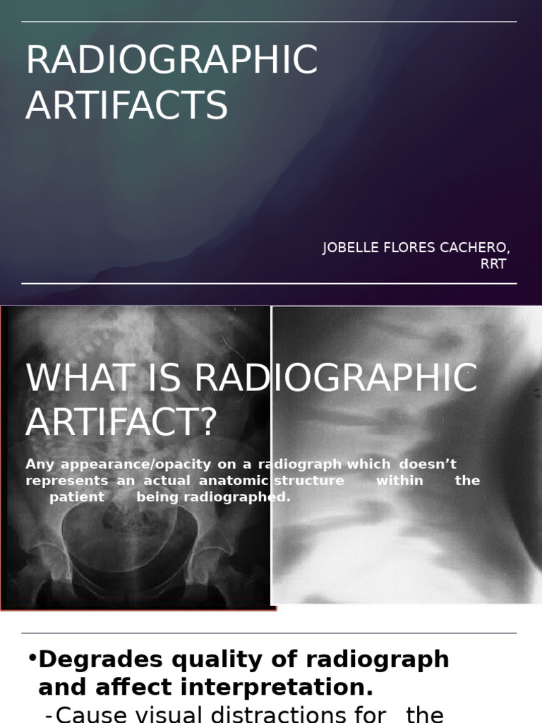Guide to Radiographic Artifacts | PDF | Radiography | Imaging