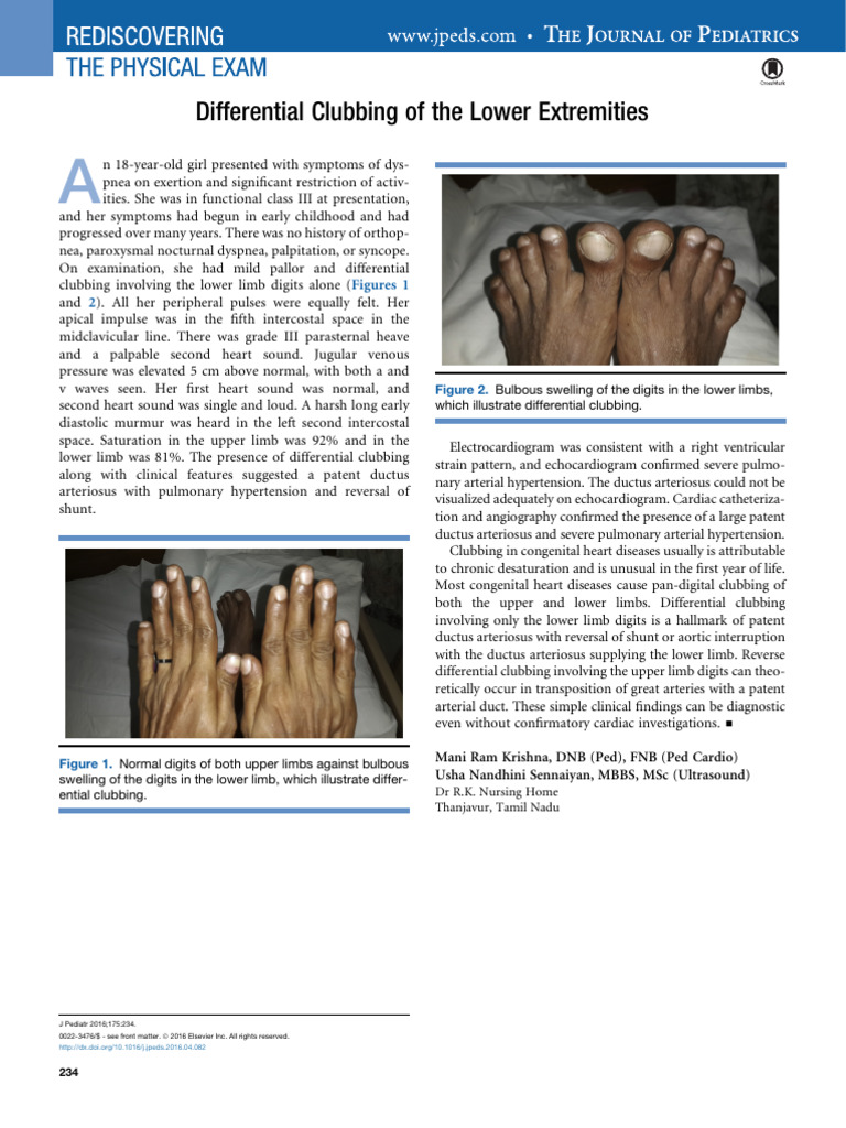 Differential Clubbing of The Lower Extremities 201 | PDF | Heart ...