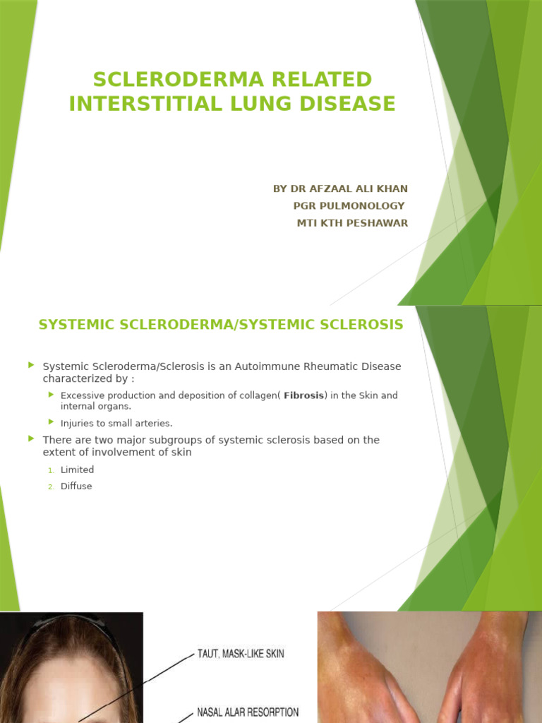 Scleroderma ILD New | PDF | Hematopoietic Stem Cell Transplantation ...