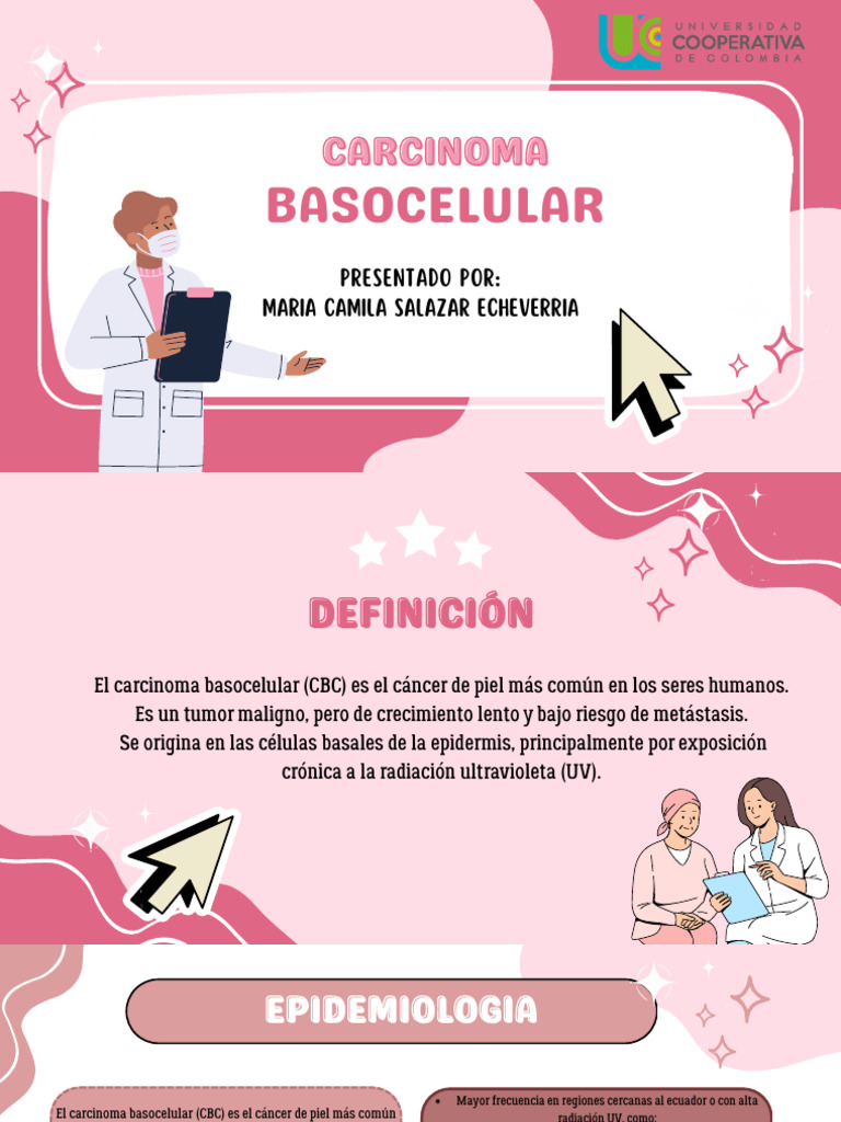 Carcinoma Basocelular | PDF | Cáncer | Neoplasias