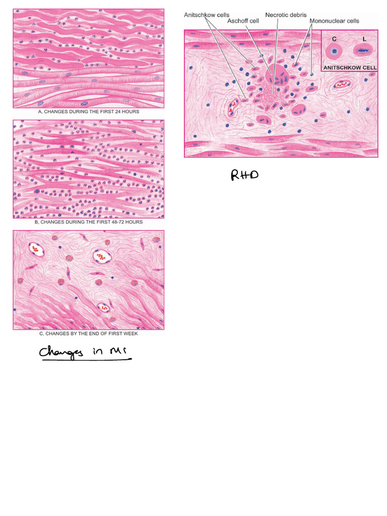Patho Diagrams | PDF