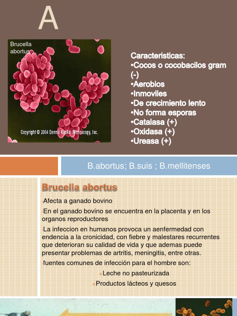 Brucella | PDF | Microbiología | Epidemiología