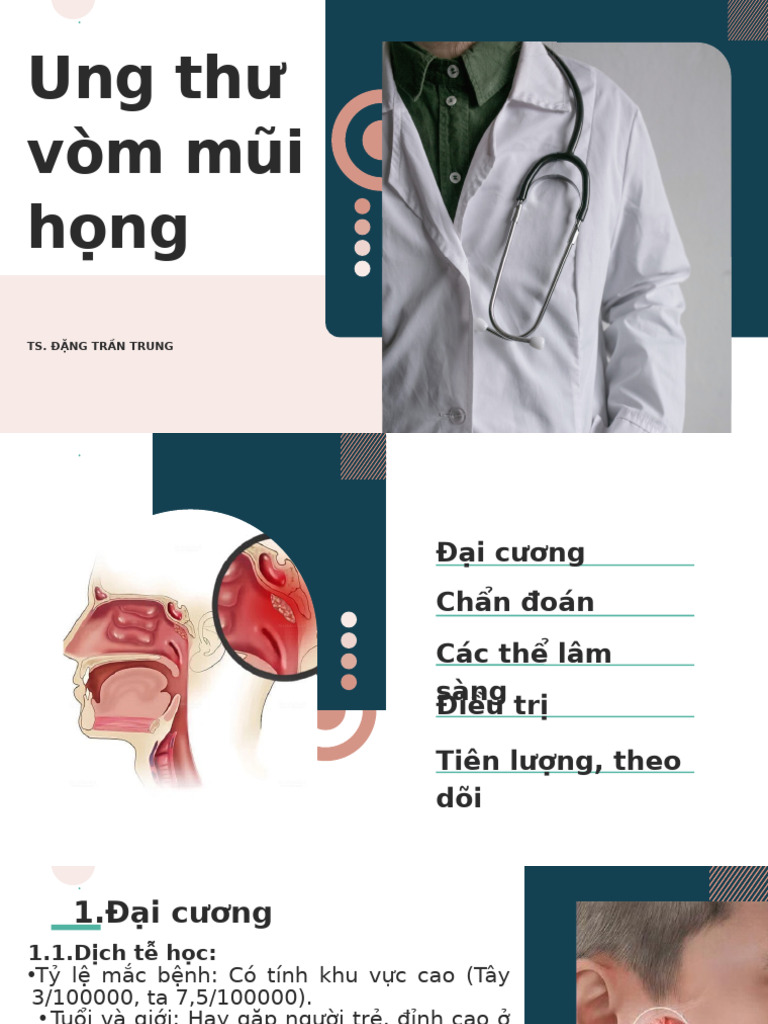 Ung Thư Vòm Mũi Họng | PDF