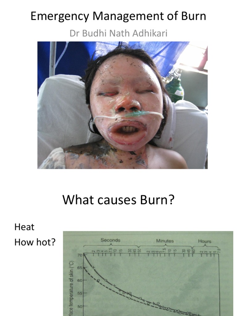 Emergency Management of Burn | PDF | Burn | Sepsis