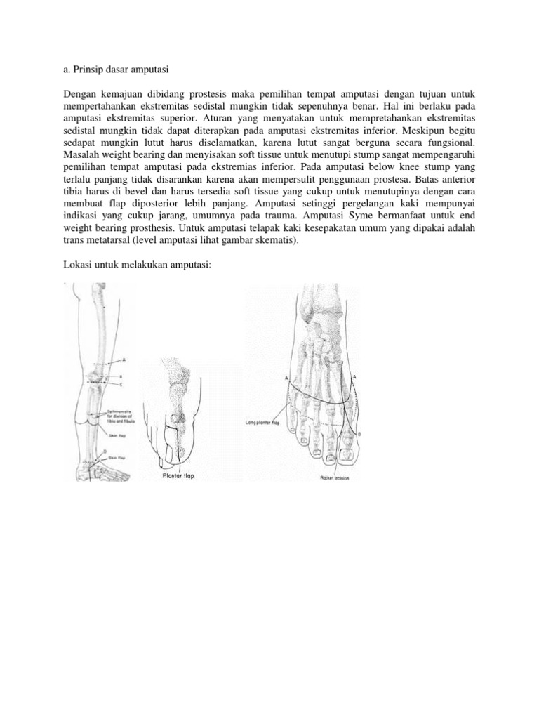 Amputasi | PDF