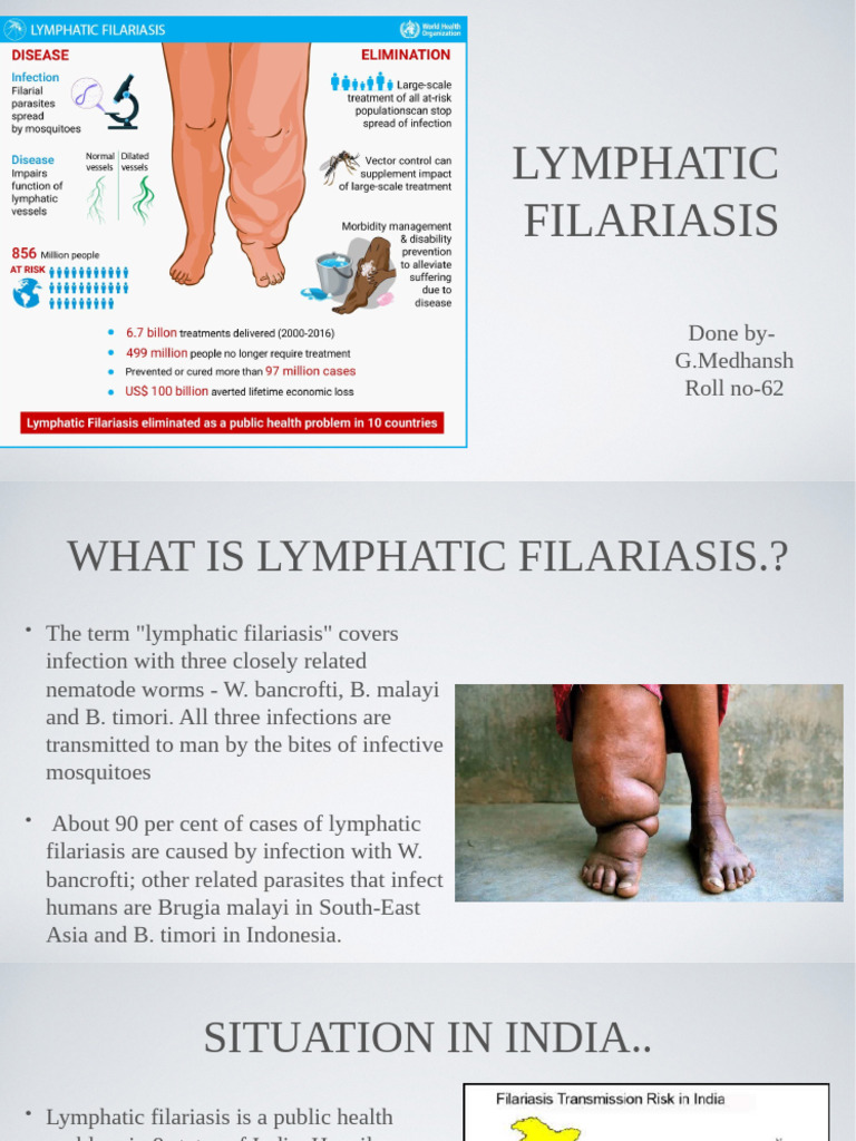 Understanding Lymphatic Filariasis in India | PDF | Medical Specialties ...