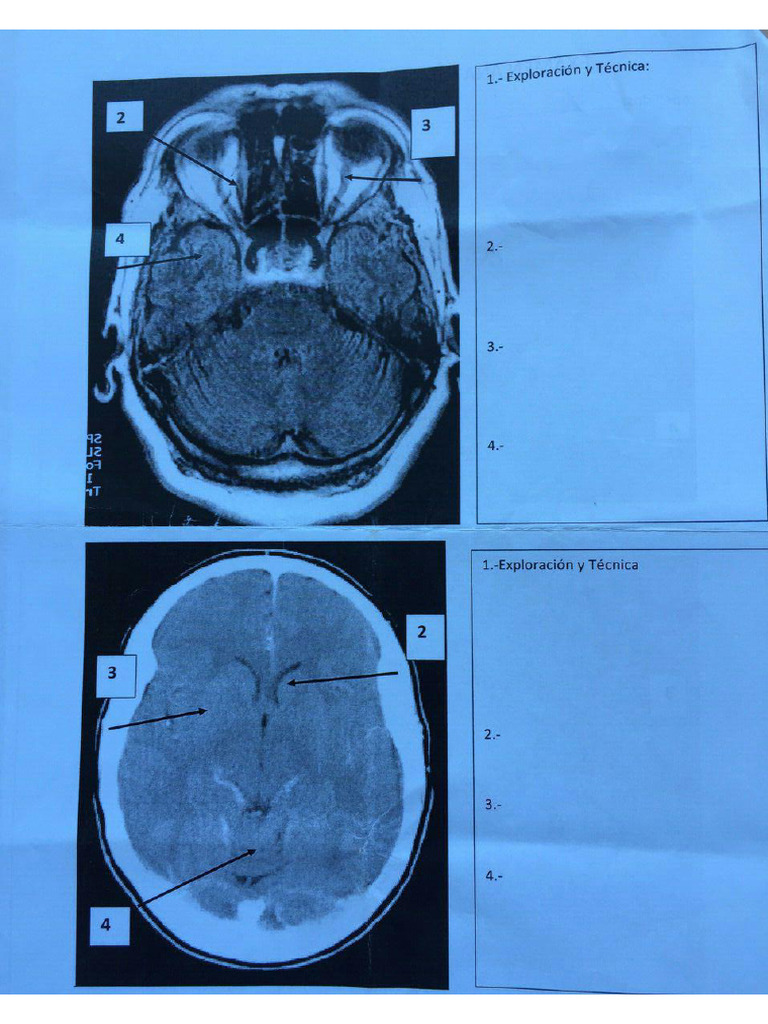 Examen ATI Mayo 2014 | PDF