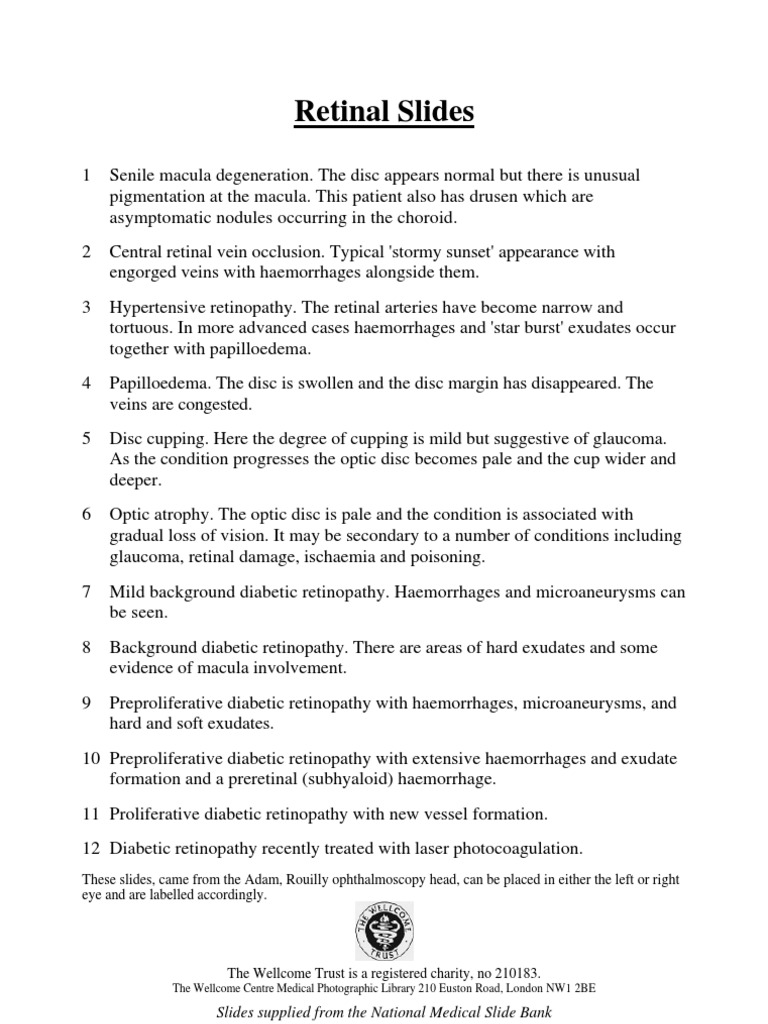 The Eye Slides | PDF