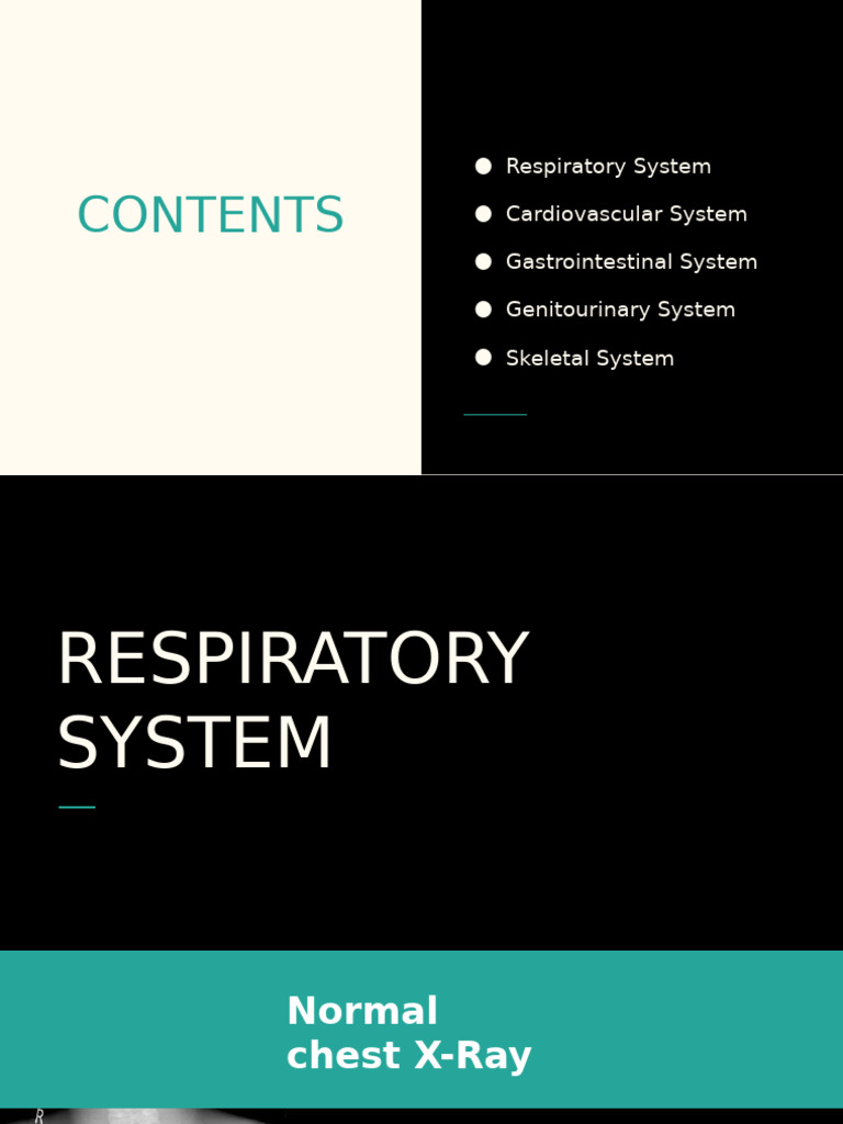 Copy of Common X-rays in Pediatrics | PDF | Congenital Heart Defect | Ventricle (Heart)
