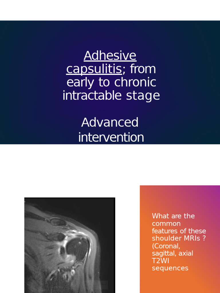 Adhesive Capsulitis 2025pptx | PDF | Shoulder | Anatomical Terms Of Motion
