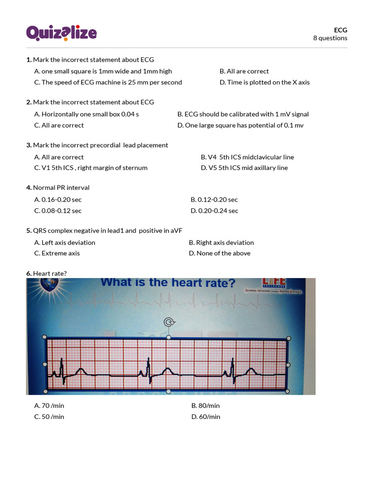 ECG Quiz: Test Your Knowledge | PDF