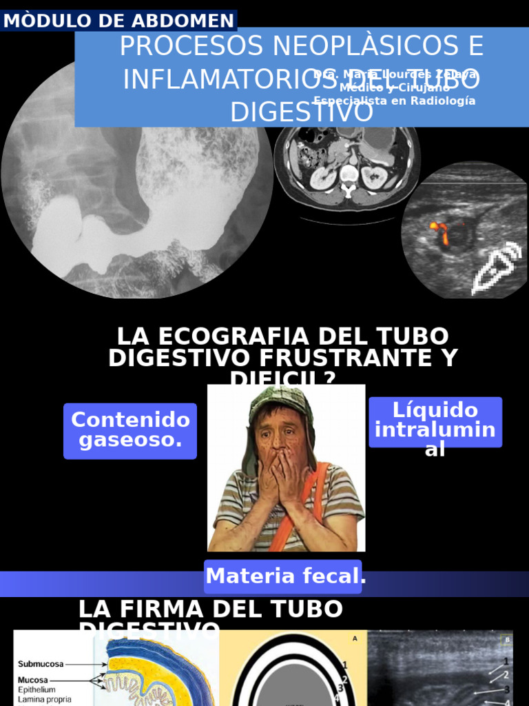 Neoplasias. Tubo Digsproc. Inflamat. - Copia | PDF | Tracto ...