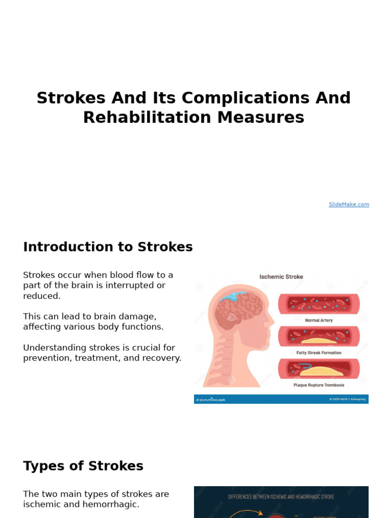 Understanding Strokes and Recovery | PDF | Stroke | Diseases And Disorders