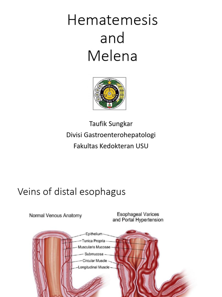 GIS1 K15 Hematemesis Dan Melena | PDF | Intravenous Therapy | Medical Specialties