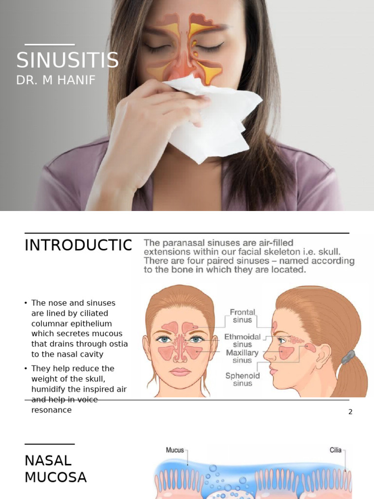Sinusitis | PDF