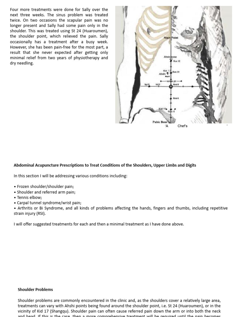 Abdominal Acupuncture 181 190 | PDF | Elbow | Pain